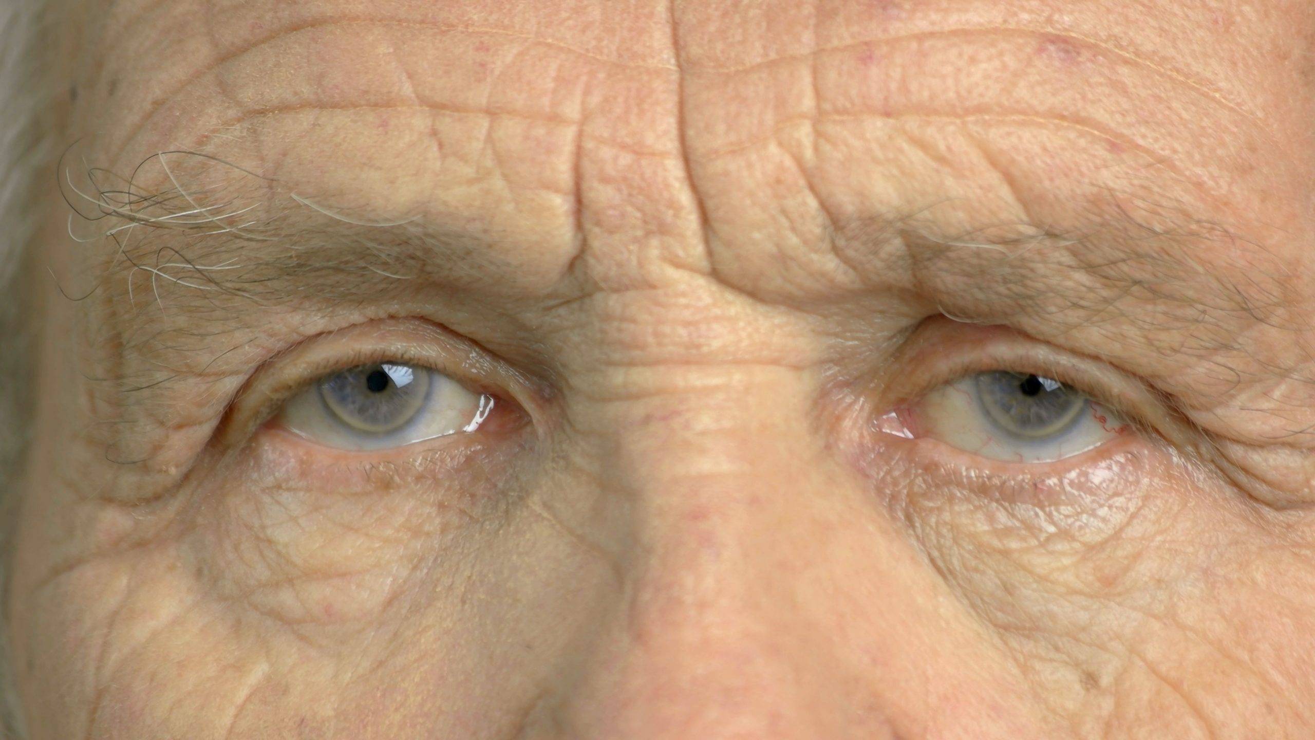 Cataract Surgery Why Second Eye Cataract Surgery Is Important Cataract Surgery Why Second Eye Cataract Surgery Is Important